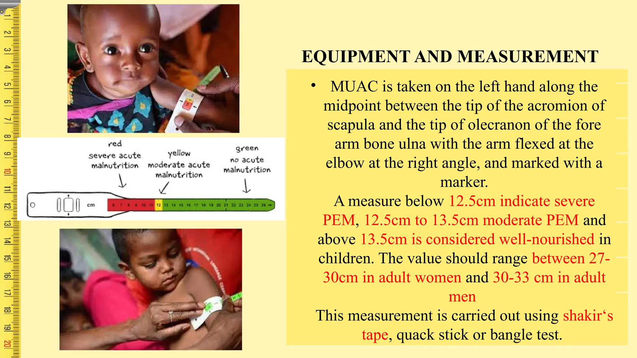 ANTHROPOMETRIC INDICATORS AND ASSESSMENT OF THE NUTRITIONAL STATUS.pptx ...