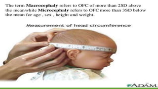 Anthropometric measurement in Infants | PPTX