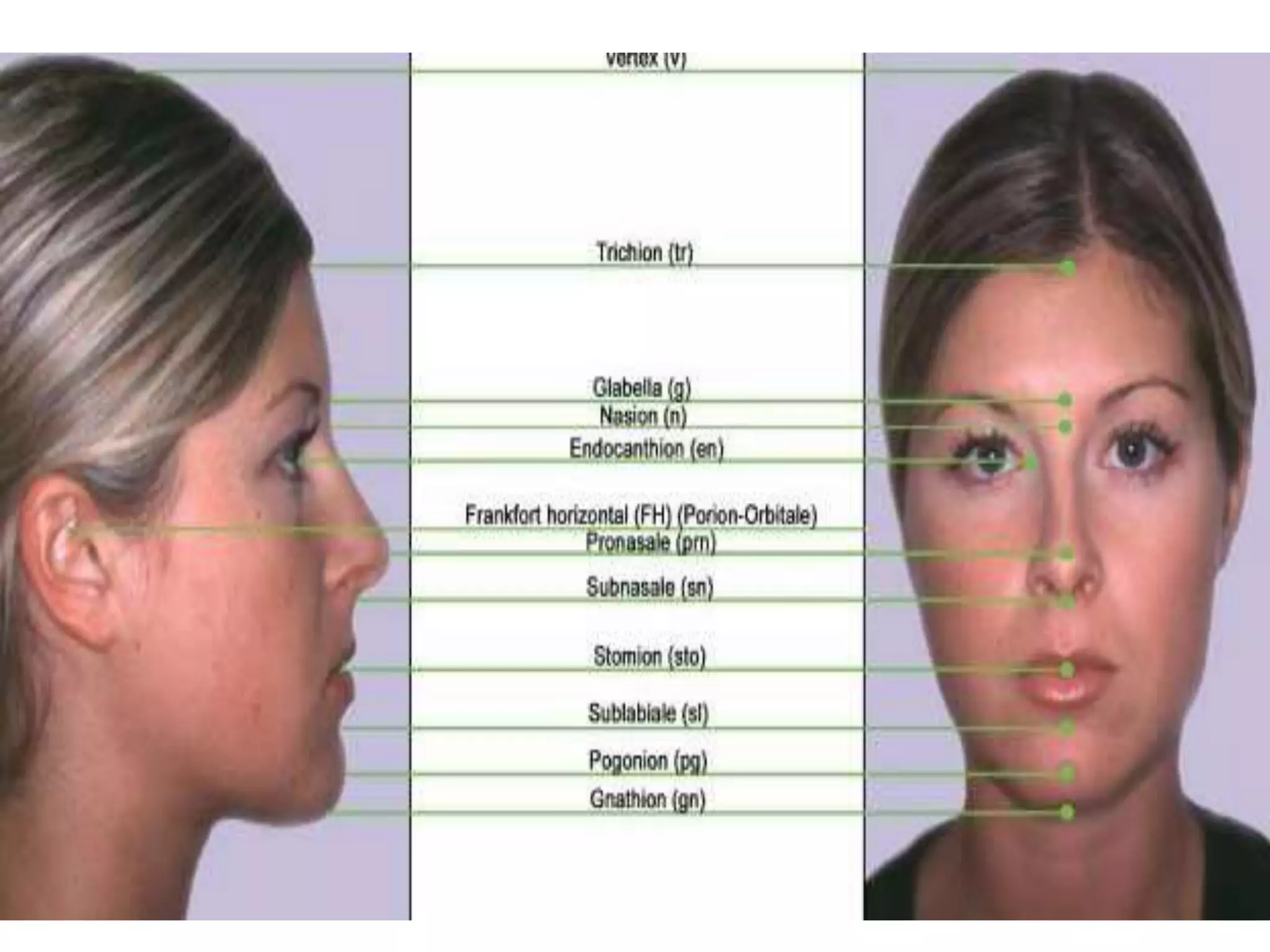 Anthropometry and cephalometric facial analysis | PPTX