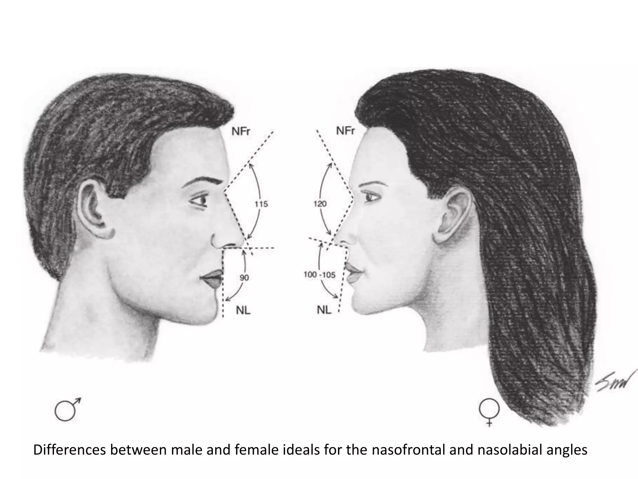 Anthropometry and cephalometric facial analysis | PPTX