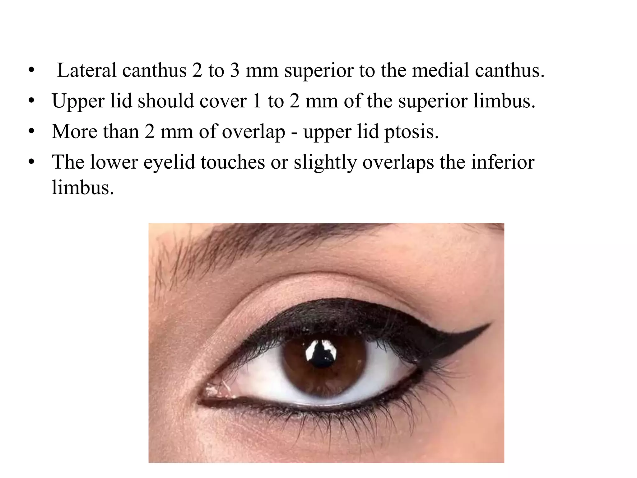 Anthropometry and cephalometric facial analysis | PPTX