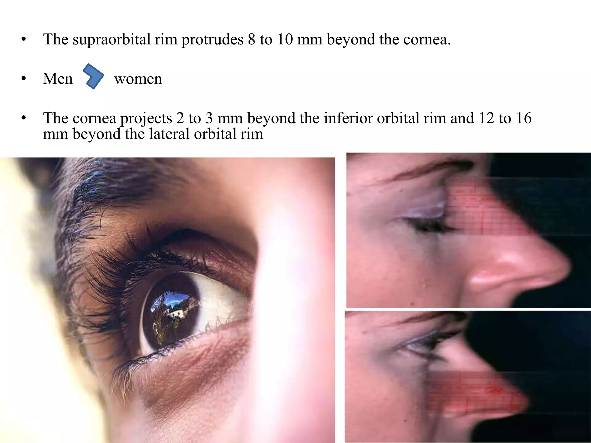 Anthropometry and cephalometric facial analysis | PPTX