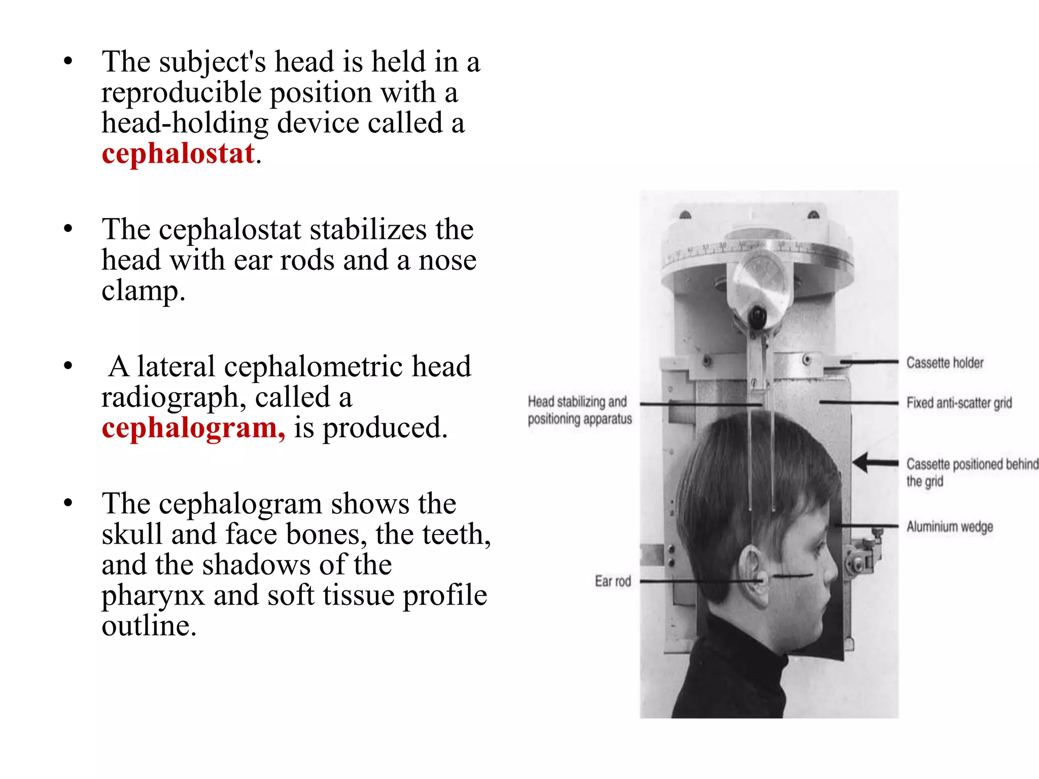 Anthropometry and cephalometric facial analysis | PPTX