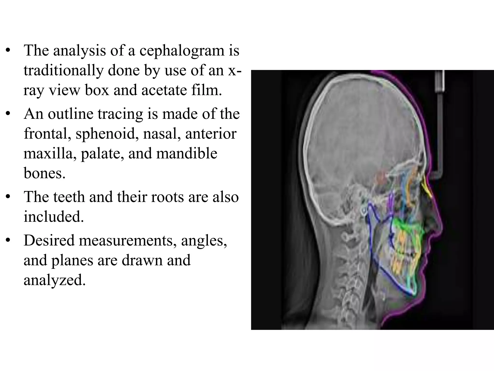 Anthropometry and cephalometric facial analysis | PPTX