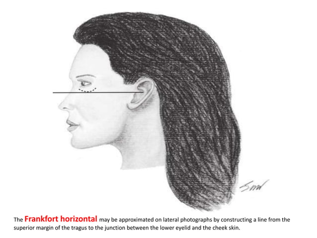 Anthropometry and cephalometric facial analysis | PPTX | Skin Care | Beauty