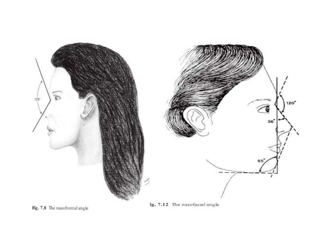 Anthropometry and cephalometric facial analysis | PPTX | Skin Care | Beauty