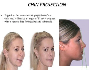 Anthropometry and cephalometric facial analysis | PPTX