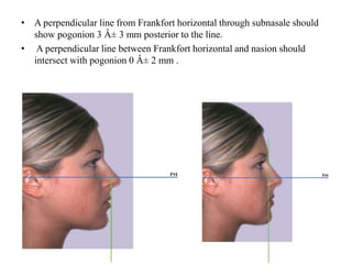 Anthropometry and cephalometric facial analysis | PPTX