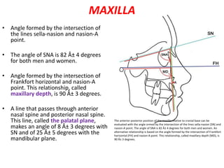 Anthropometry and cephalometric facial analysis | PPTX