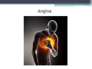 Anti angina drugs | PPT