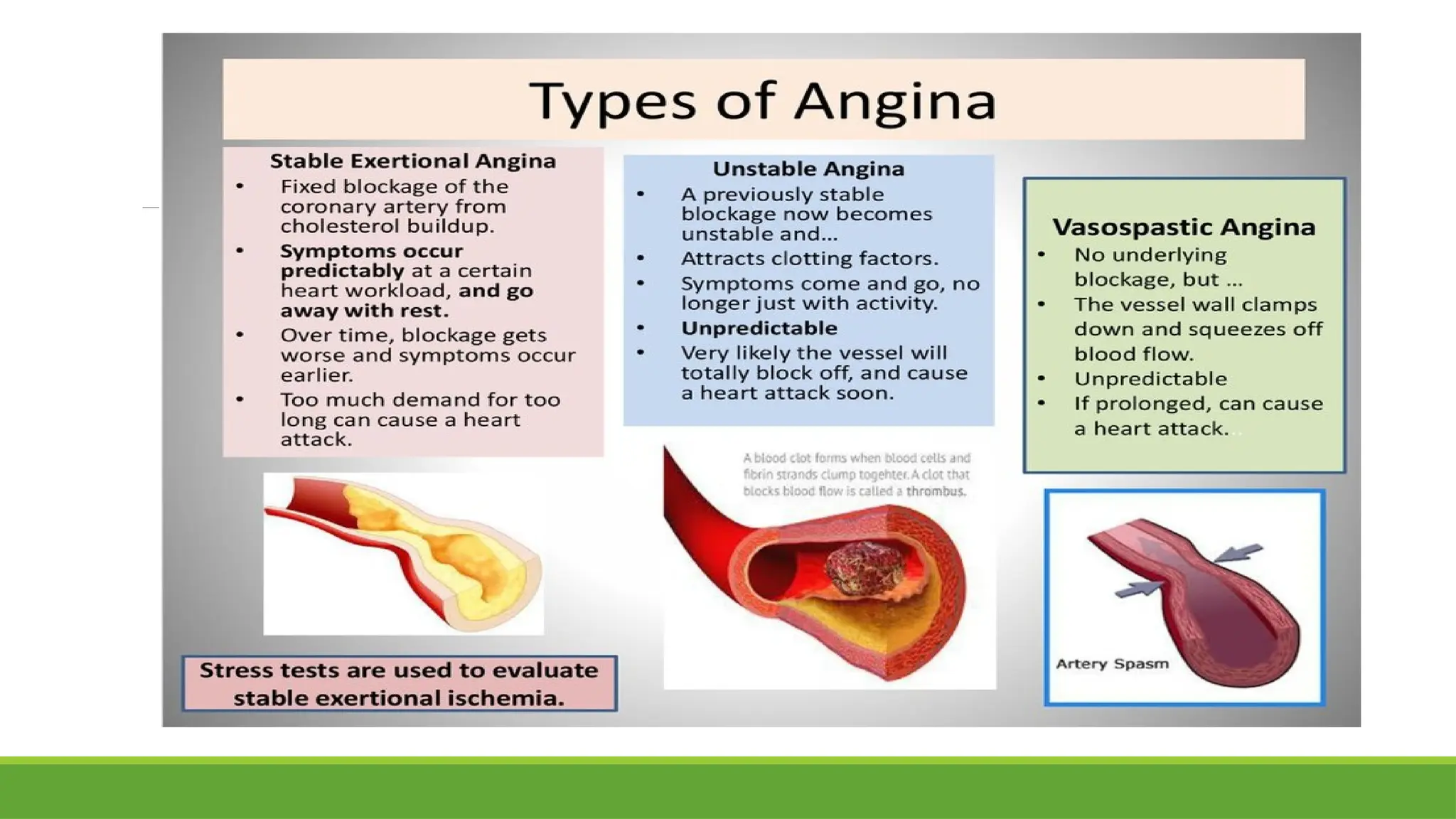 PRE CLINICAL SCREENING METHOD OF ANTI ANGINAL DRUGS | PPTX