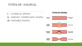 PRE CLINICAL SCREENING METHOD OF ANTI ANGINAL DRUGS | PPTX