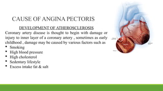 PRE CLINICAL SCREENING METHOD OF ANTI ANGINAL DRUGS | PPTX