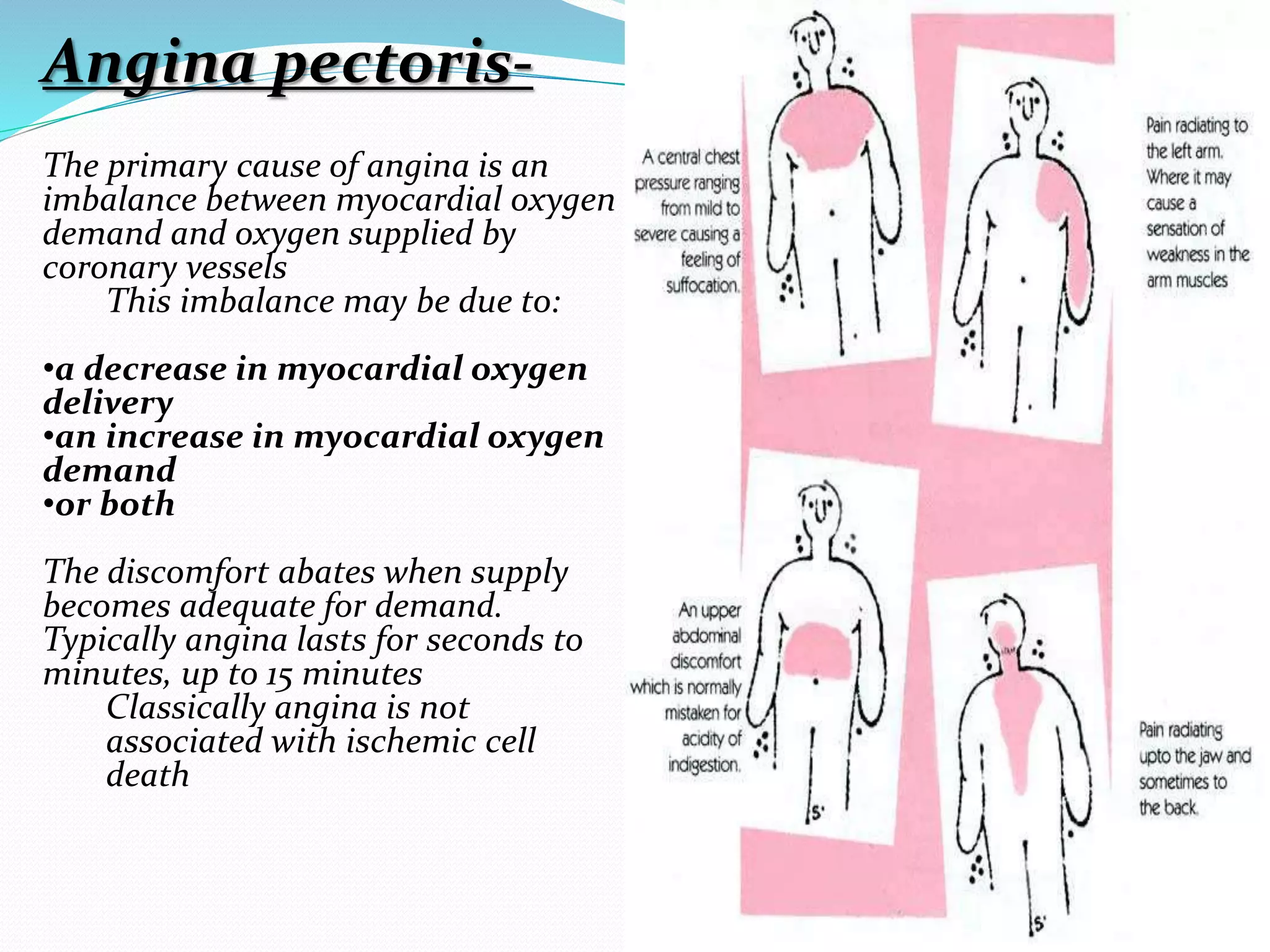 Anti anginal drugs. | PPTX | Heart and Cardiovascular Diseases ...