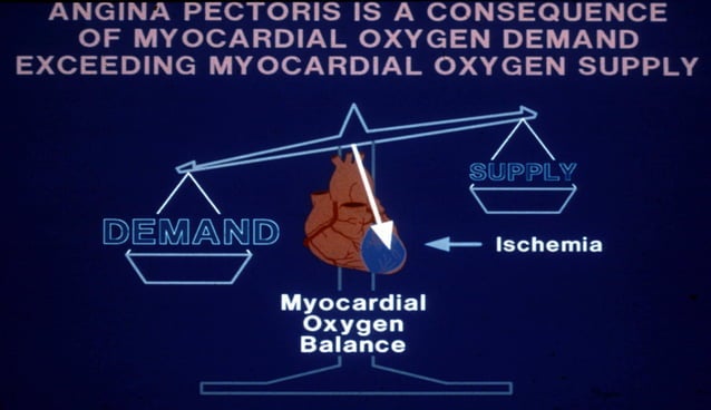 Anti Anginal drugs | PDF | Heart and Cardiovascular Diseases | Diseases ...