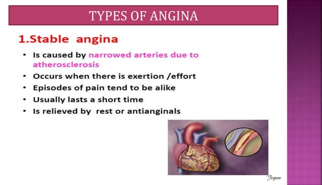 Anti Anginal drugs | PDF | Heart and Cardiovascular Diseases | Diseases ...