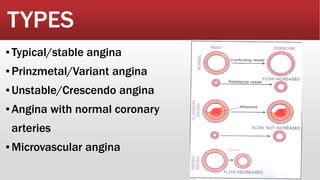 Anti anginal drugs, uses, mechanism of action, adverse effects | PPTX