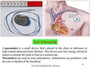 Anti Arrhythmic Drugs | PPT