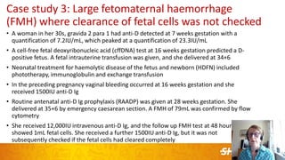 Anti-D Presentation - Anti-D Lessons from SHOT - Serious Hazards of ...