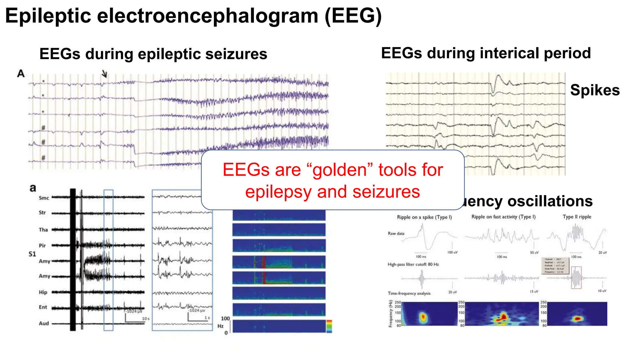Anti-epileptic drugs pharmacology.pptx
