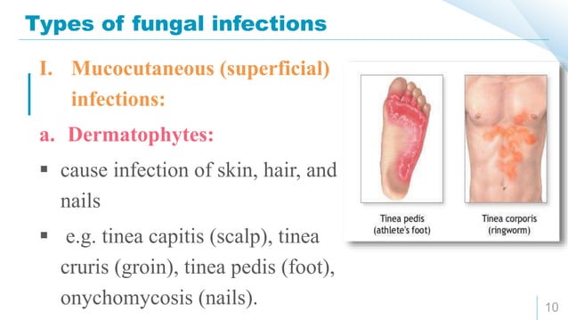 Anti-Fungal drugs | PPTX