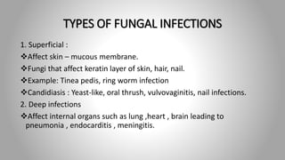 Anti fungal drugs | PPT