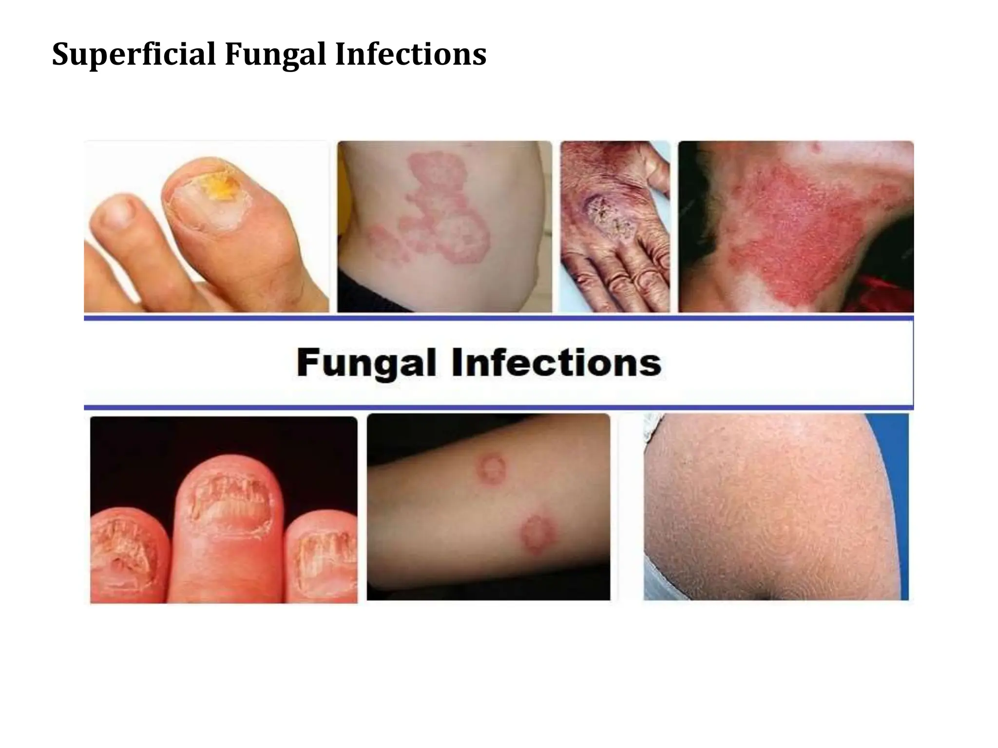 Fungus, types and Anti-Fungals - General.pdf
