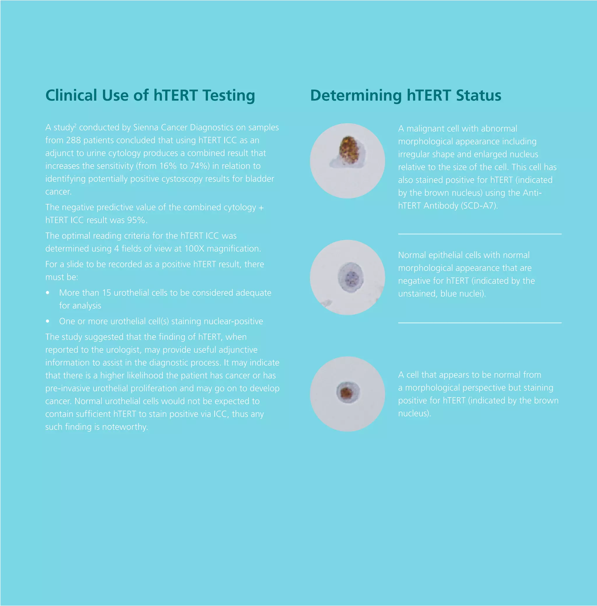 Anti hTERT-catalog - StatLab | PDF