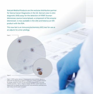 Anti hTERT-catalog - StatLab | PDF