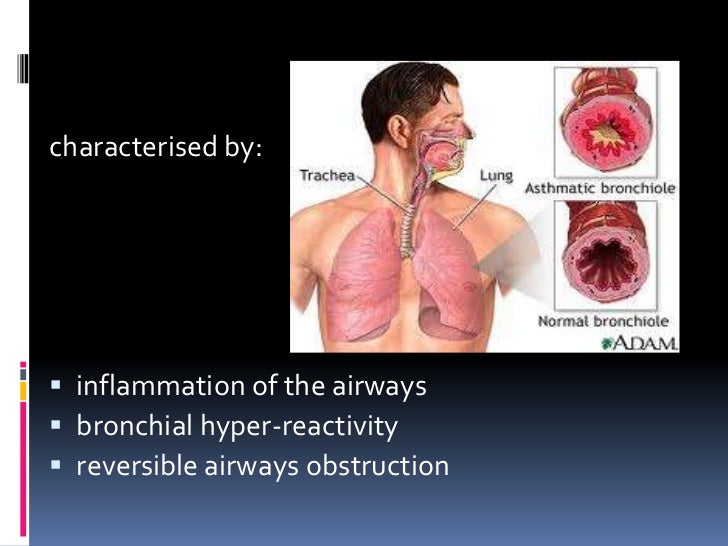 characterised by: inflammation of the