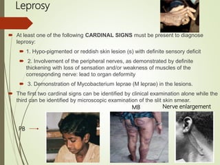 Leprosy & Anti-Leprotic Drugs | PPTX