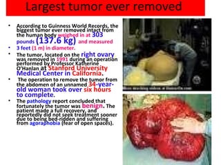 ANTI CANCER DRUGS[ANTI-NEOPLASTIC DRUGS] MEDICINAL CHEMISTRY BY P ...