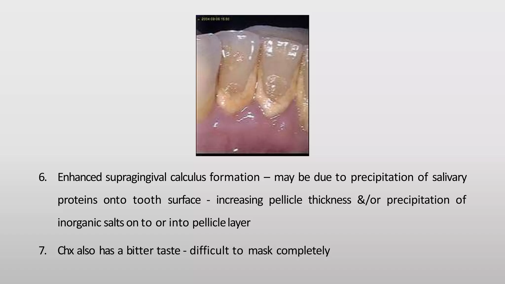 Anti plaque agents, Dr Sai Lakshmi | PPTX