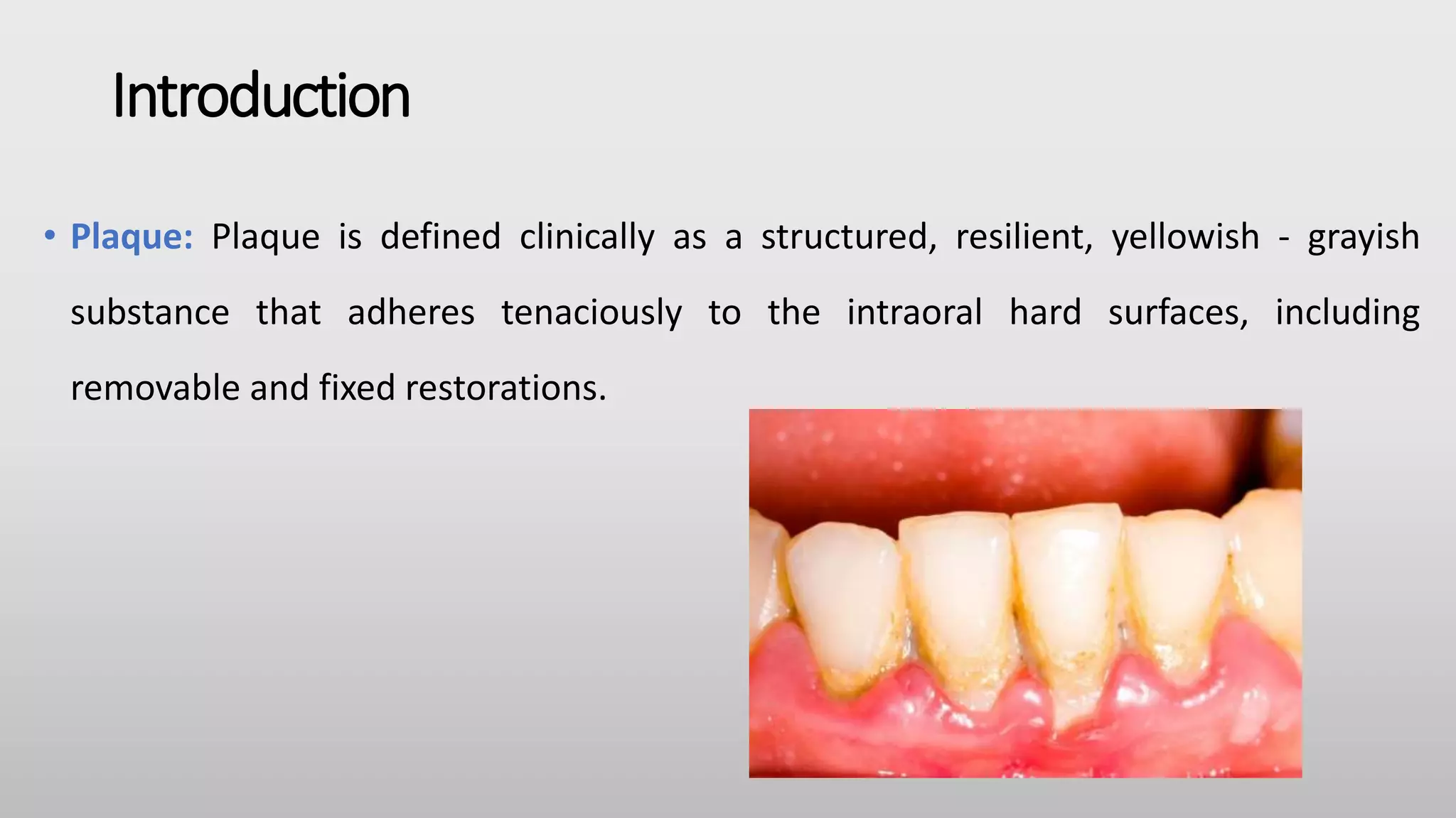 Anti plaque agents, Dr Sai Lakshmi | PPTX