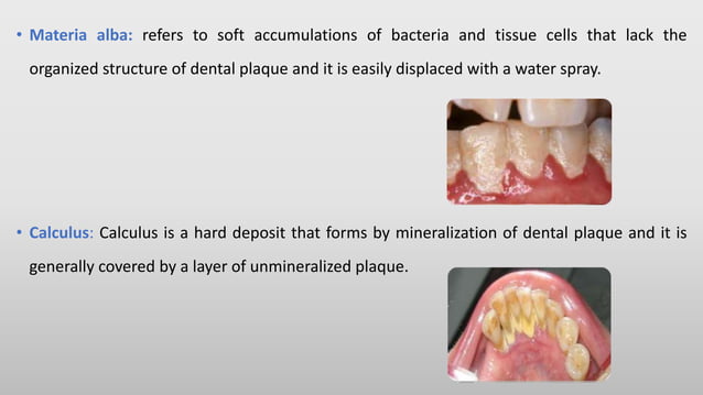 Anti plaque agents, Dr Sai Lakshmi | PPTX