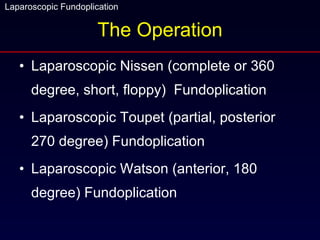 Anti reflux surgery | PPT