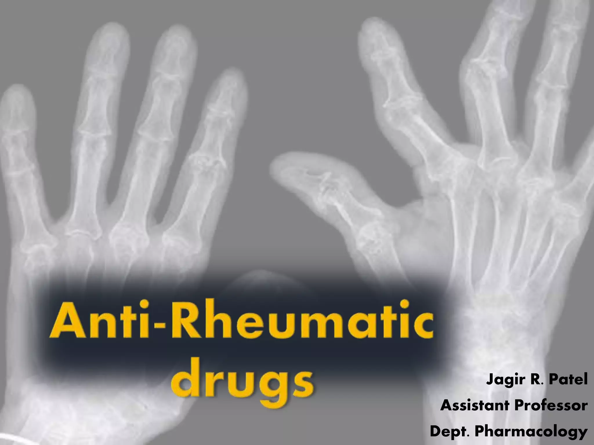 Anti-Rheumatic drugs | PPTX