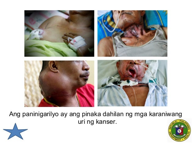 DOH Anti-Smoking Campaign
