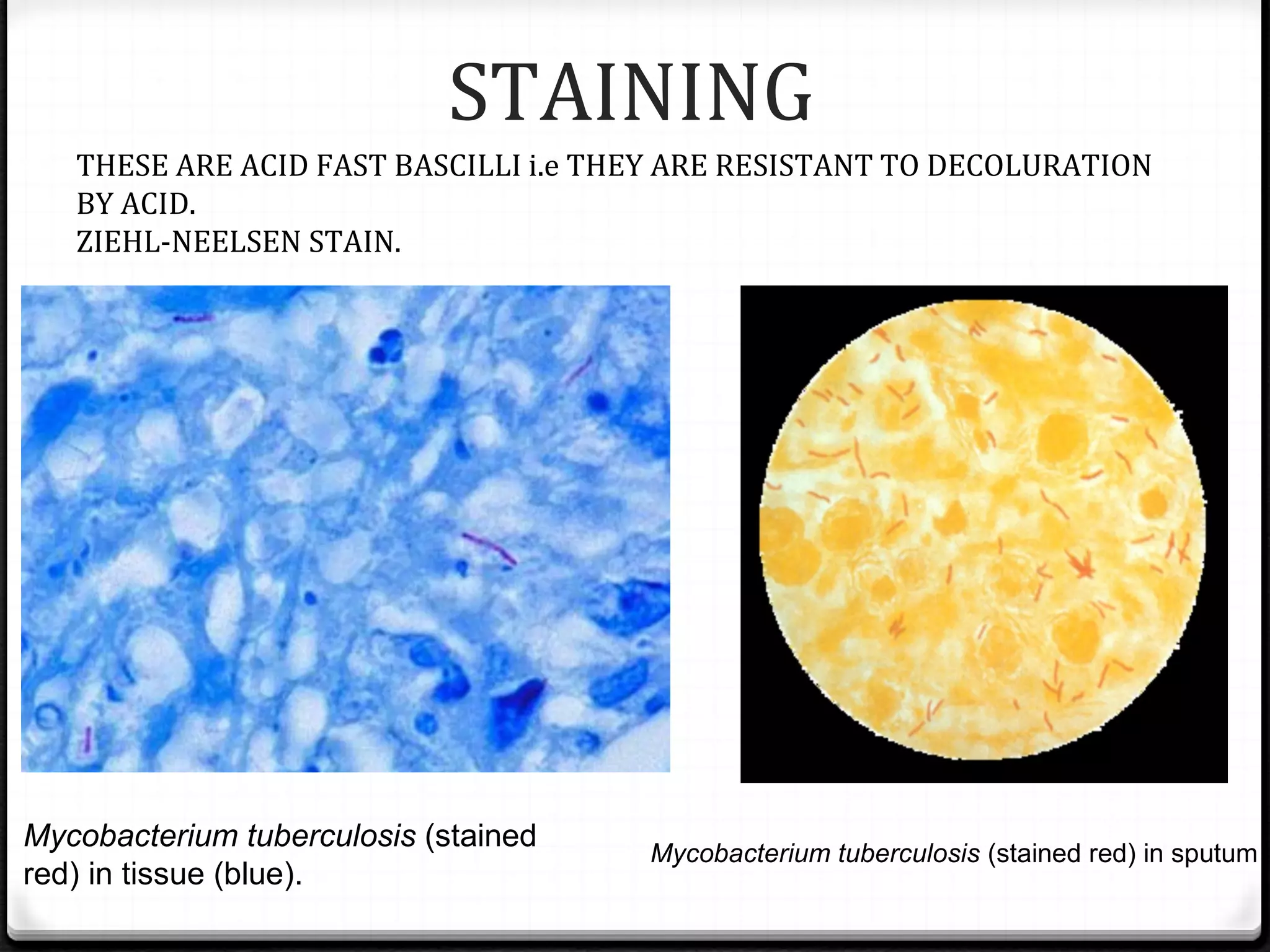 Anti tuberculosis drugs | PPT