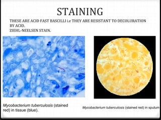 Anti tuberculosis drugs | PPT