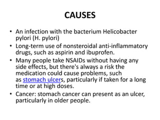 Anti ulcer drugs | PPTX