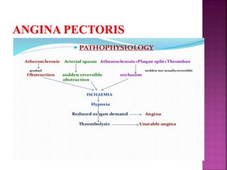 Antiangina drug | PPT