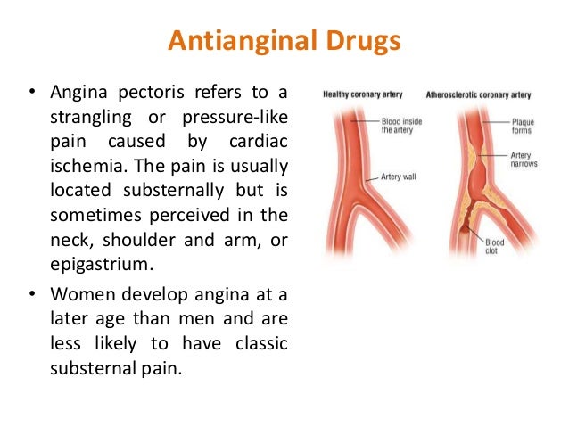 Antianginal Drugs