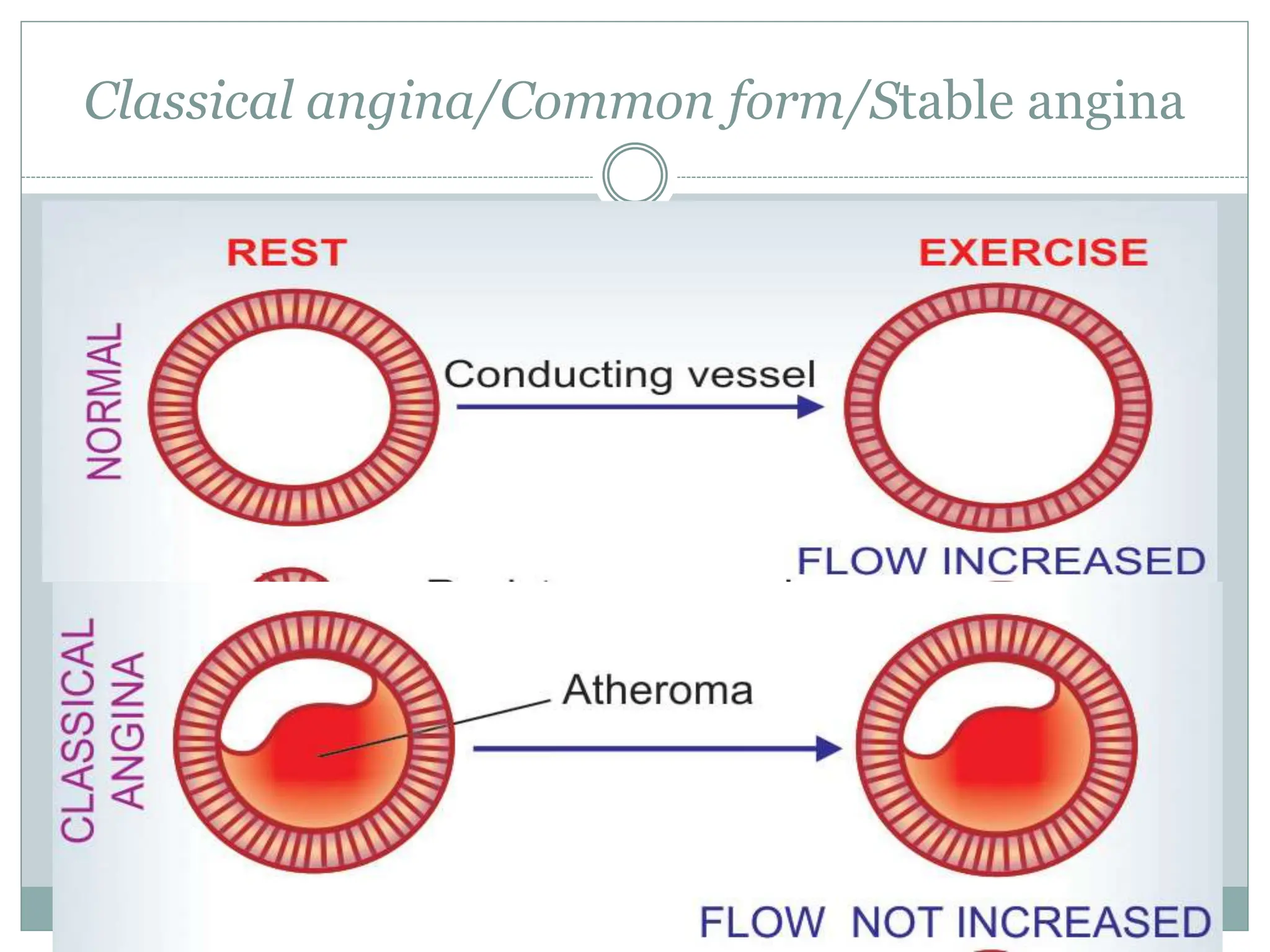 Pharmacology of Drugs used in Treatment of angina | PPTX