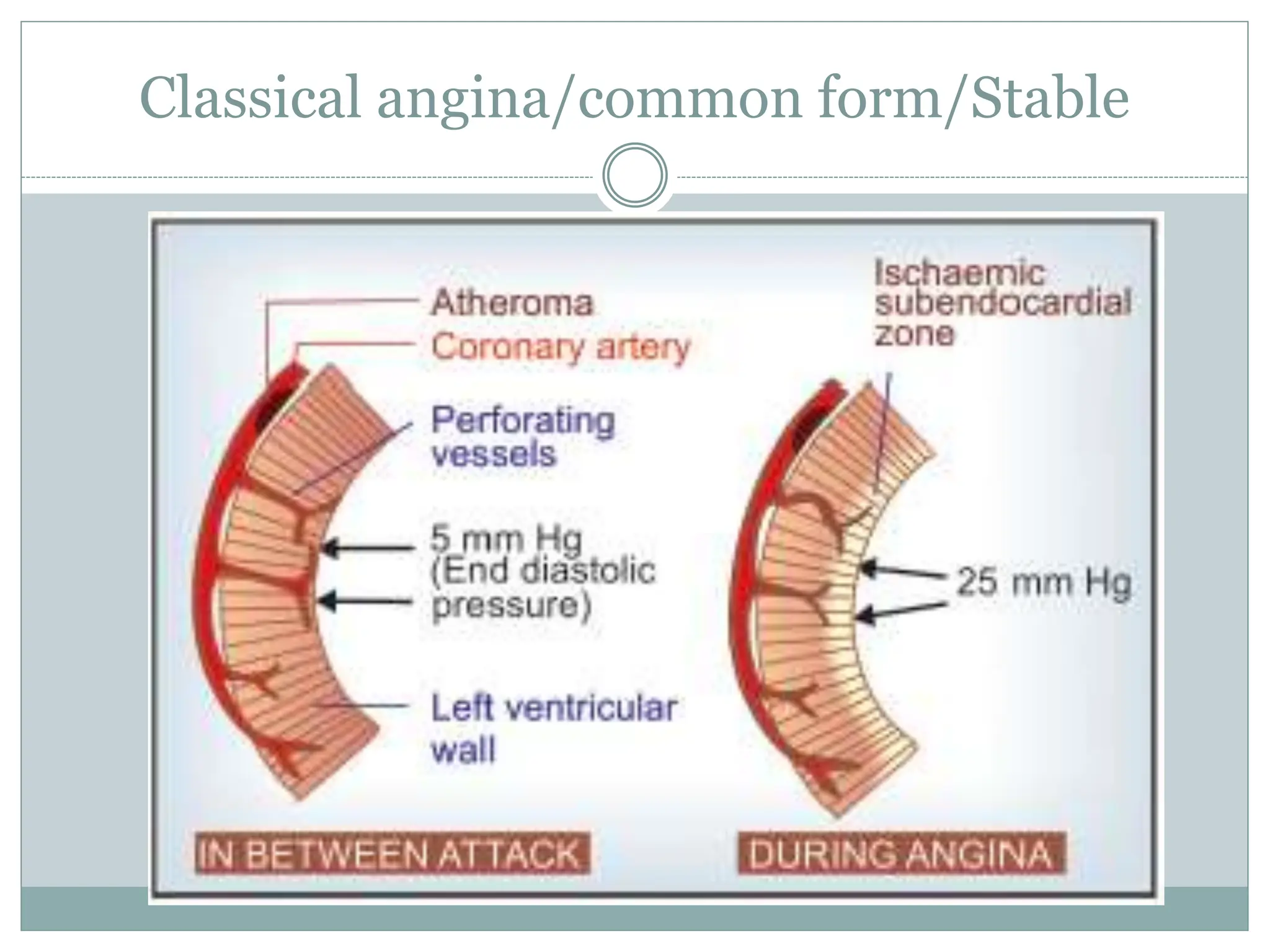 Pharmacology of Drugs used in Treatment of angina | PPTX