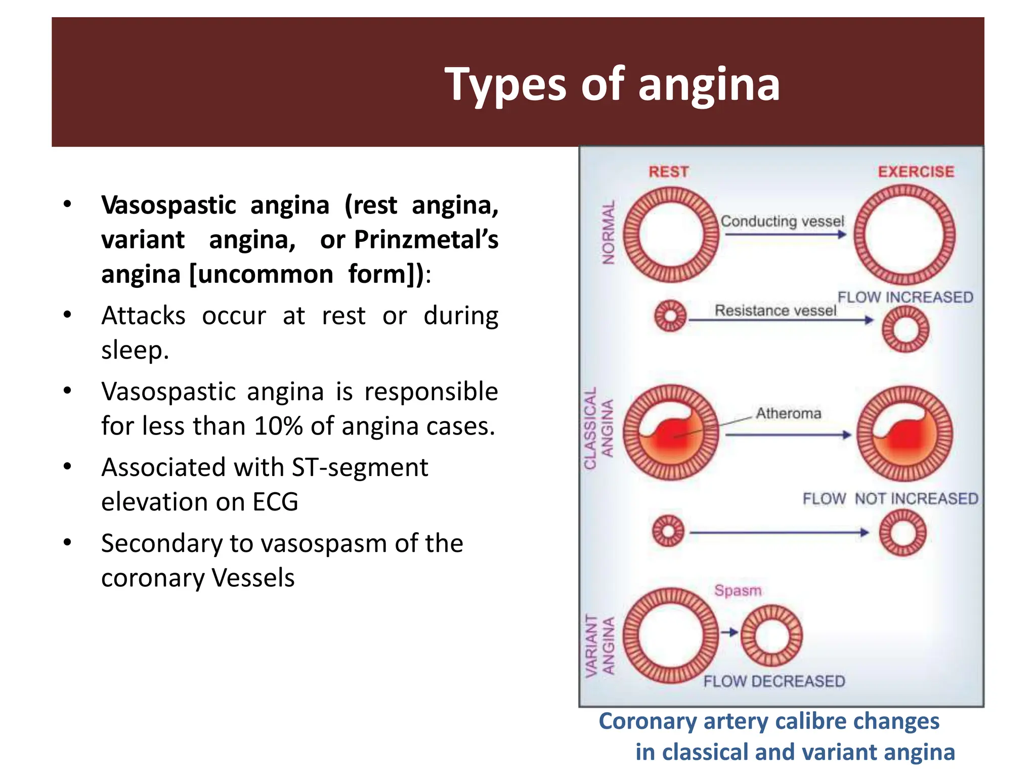 Anti Anginal Drugs and its side affect and uses | PPT