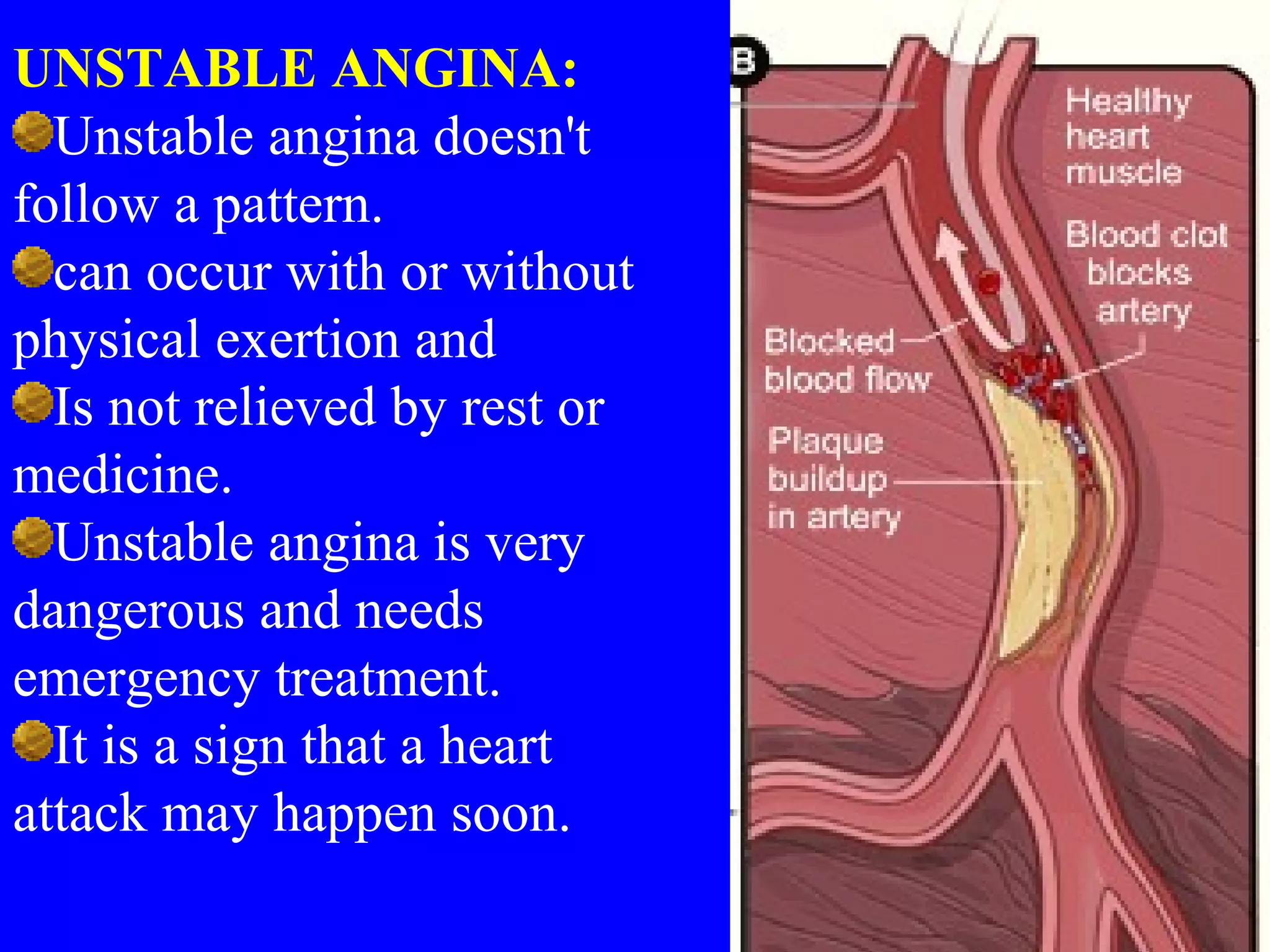 Anti anginal drugs | PPT