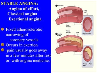 Anti anginal drugs | PPT