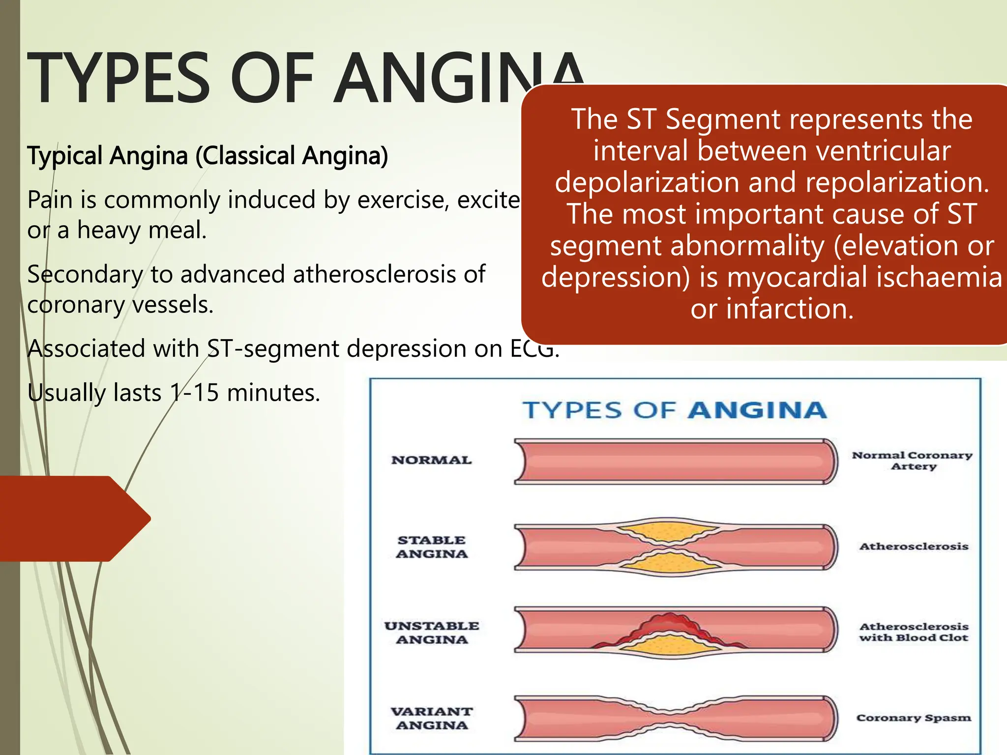 anti anginal drugs and side affect and Symptoms | PPT
