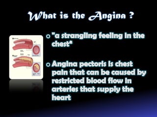 Angina and Antianginal drugs | PPT